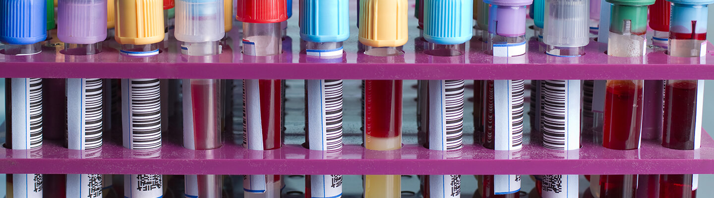 ZEBEX | Leading 2D Barcode Scanners Solution Provider